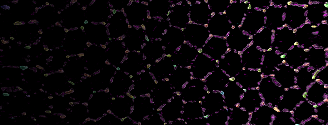 Microscopy Image Analysis Software - Imaris - Oxford Instruments